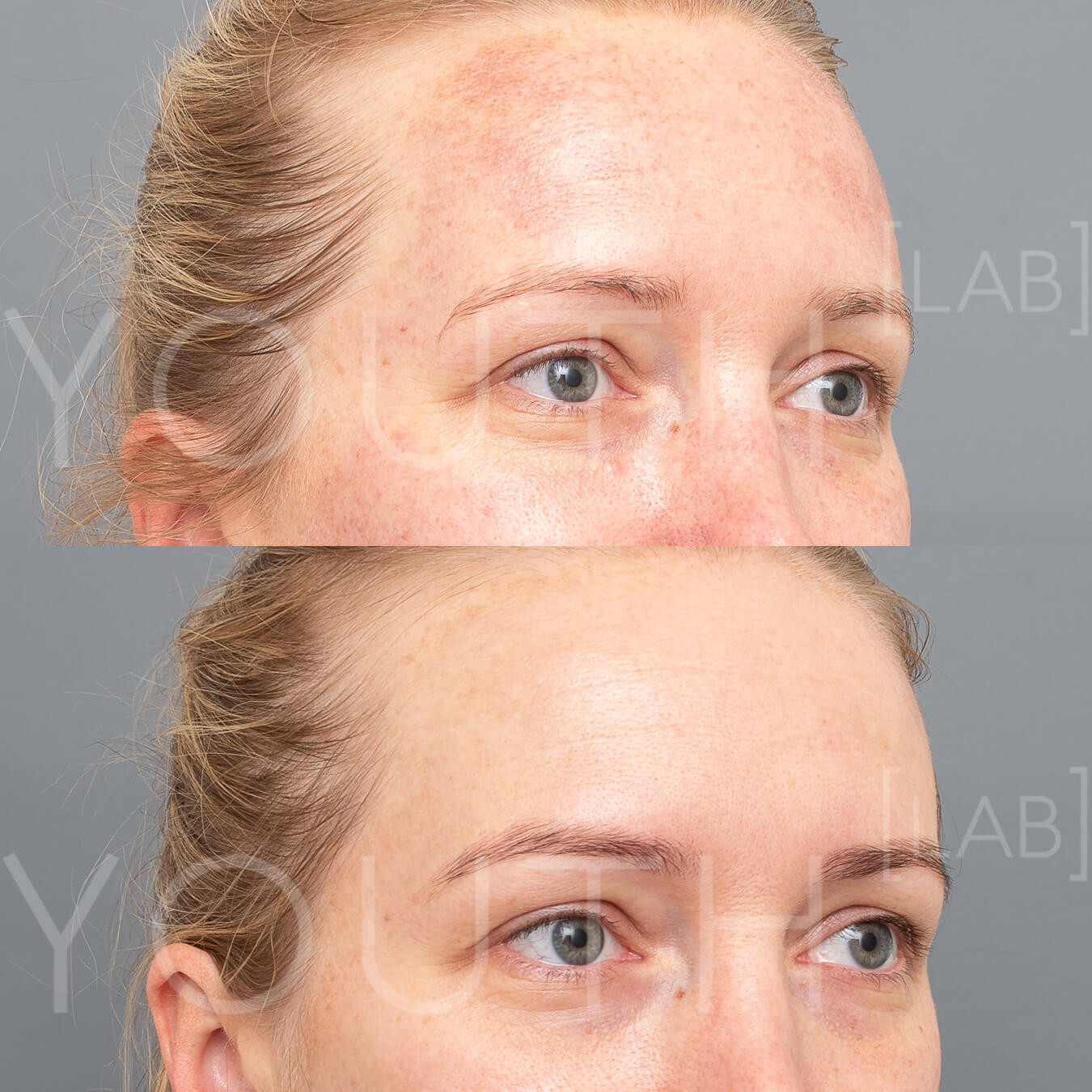 BBL Corrective - Youth Lab, Perth