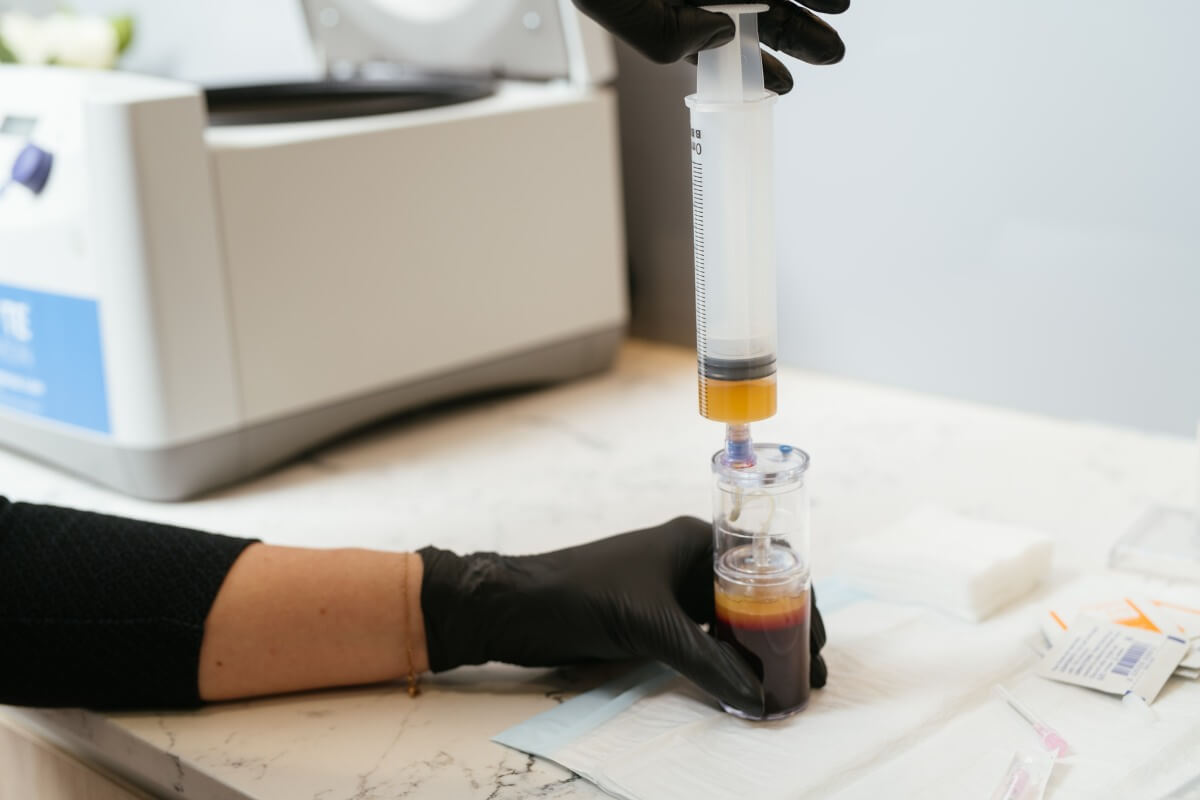 Plasma Therapy (PRP) - Youth Lab, Perth