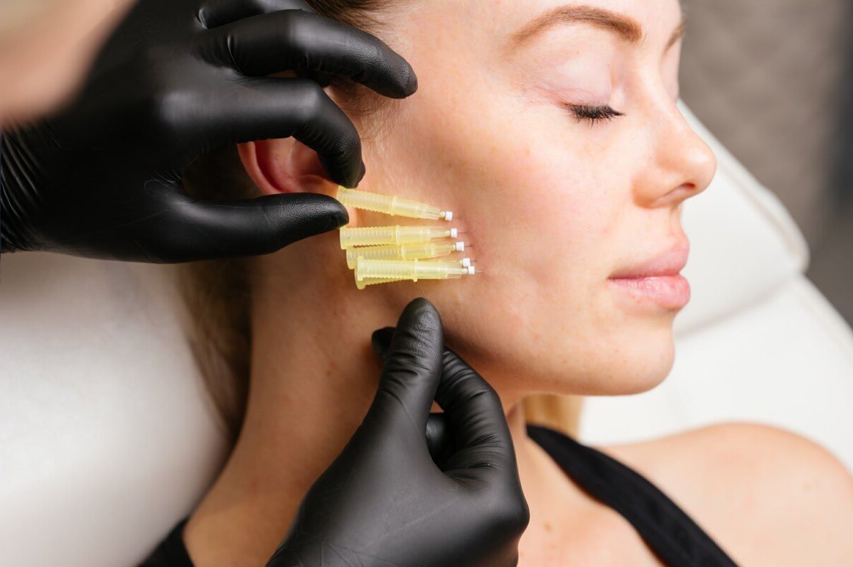 PDO PDO Mono Rejuvenating Threads - Youth Lab, Perth