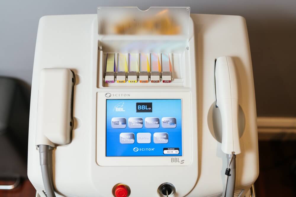 SkinTyte II Skin Tightening - Youth Lab, Perth