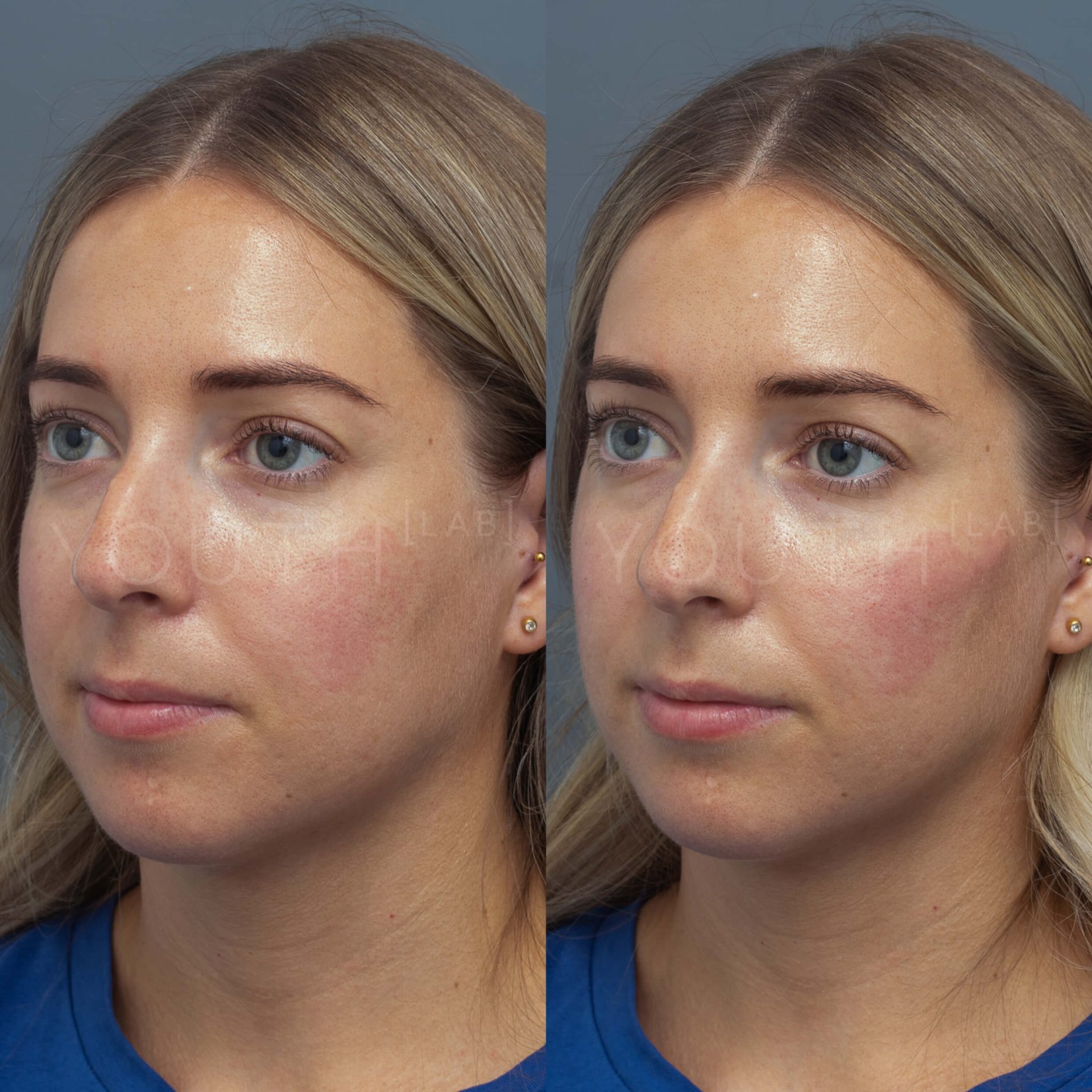 RN Isabelle - Youth Lab, Perth