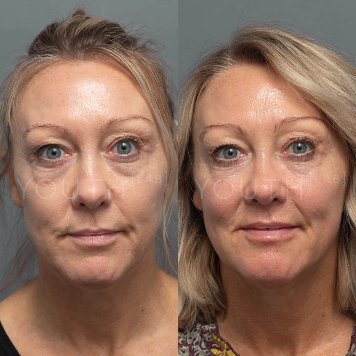 Dr Kate Jameson - Youth Lab, Perth