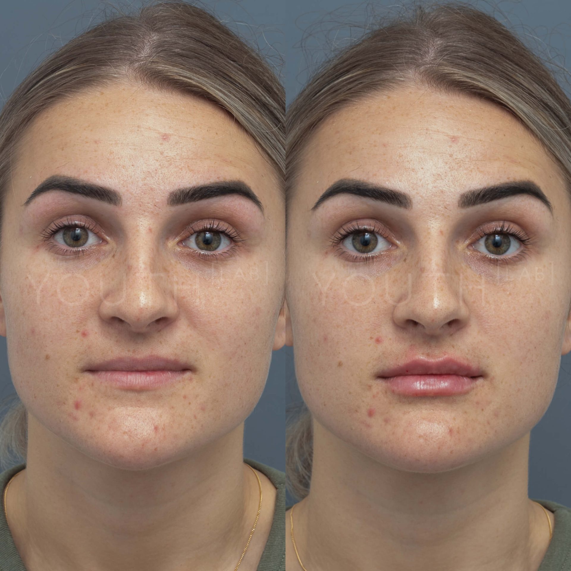 Dr Emily Alfonsi - Youth Lab, Perth