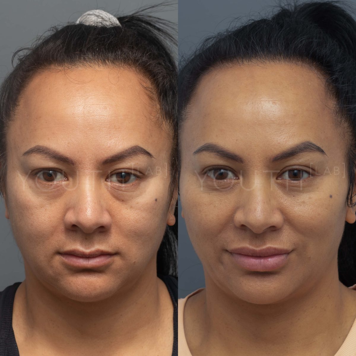 RN Danae - Youth Lab, Perth