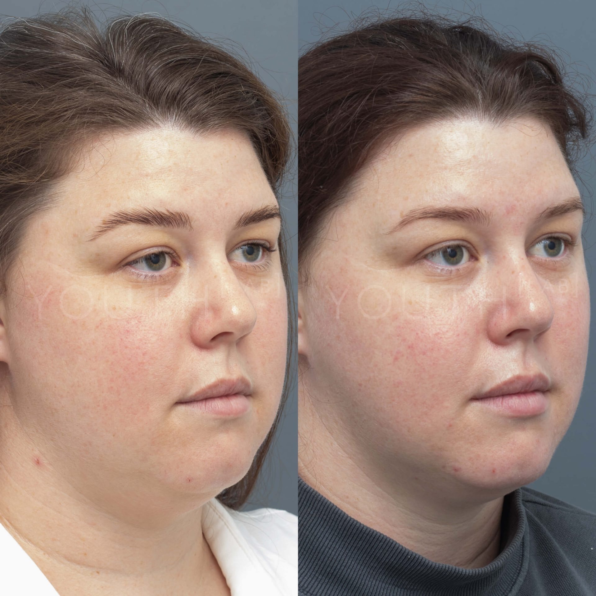 RN Isabelle - Youth Lab, Perth